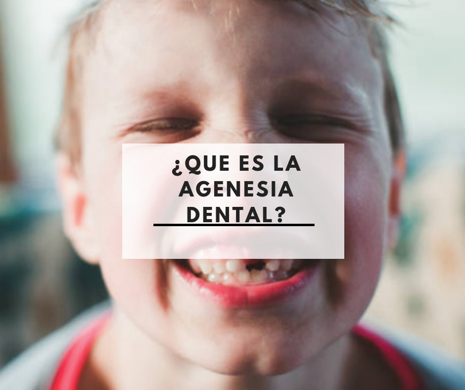 ¿En que consiste la agenesia dental? - Clinica Dental Cristina Martinez